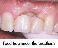 Periodontal Cosmetic Surgery in Orange County and Mission Viejo | Dr ...